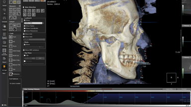 3D-Ceph Module[X-Ray Generation]