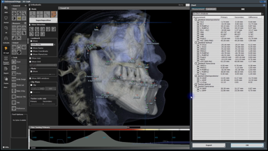 3D-Ceph Pre&Post Treatment Comparison