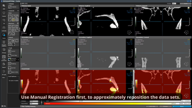 [Stitching small FOV data] Fusion Module