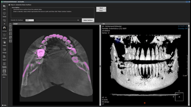 Partially Edentulous Vol1.